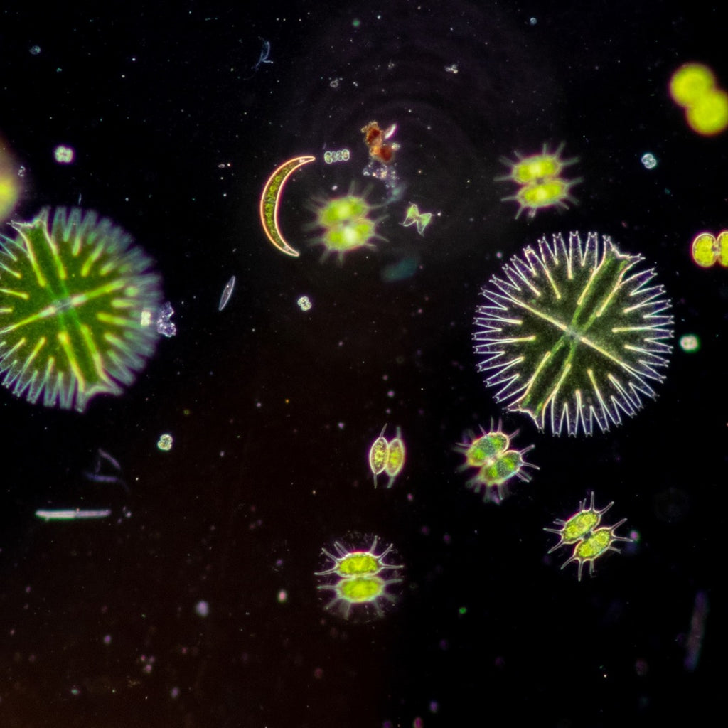 How To Usе Phytoplankton To Control Nutriеnt Imbalancеs In Rееf Tanks ...